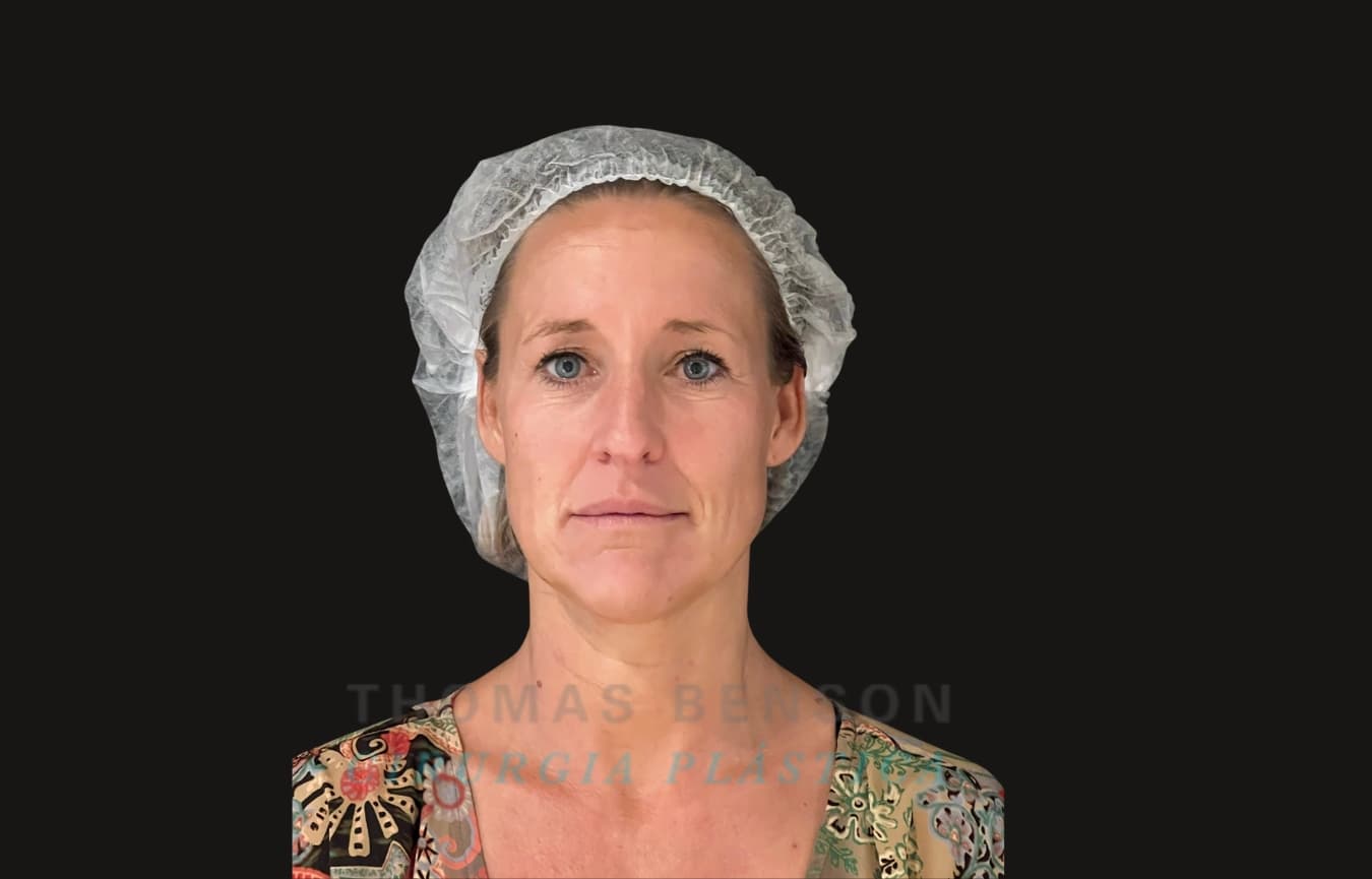 Result || Dr. Thomas Benson