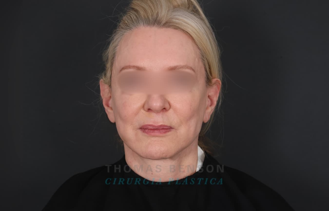 Result || Dr. Thomas Benson