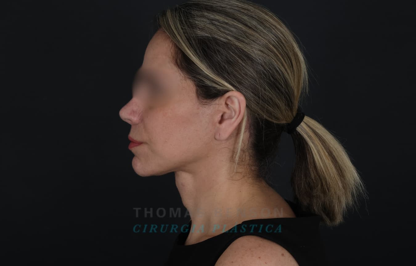 Result || Dr. Thomas Benson