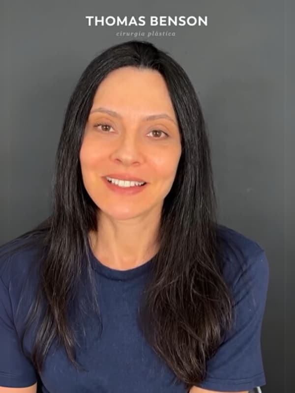 Dr. Thomas Benson, PhD - Cirurgião Plástico