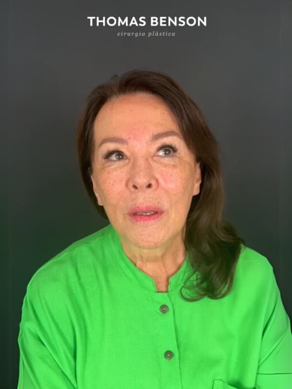 Dr. Thomas Benson, PhD - Cirurgião Plástico